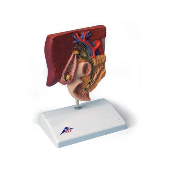 3B Scientific Gallstone Model – 3B Smart Anatomy - Halomedicals Systems ...