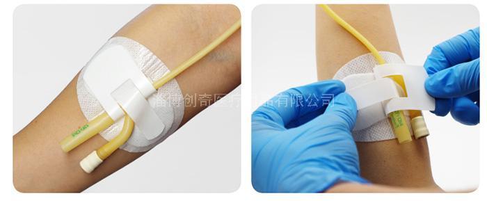 Catheter Fixation Device - Halomedicals Systems - USA