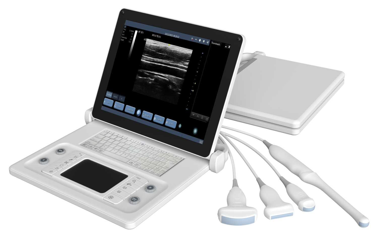 Youkey F6 Portable Ultrasound - HALOMEDICALS SYSTEMS LIMITED